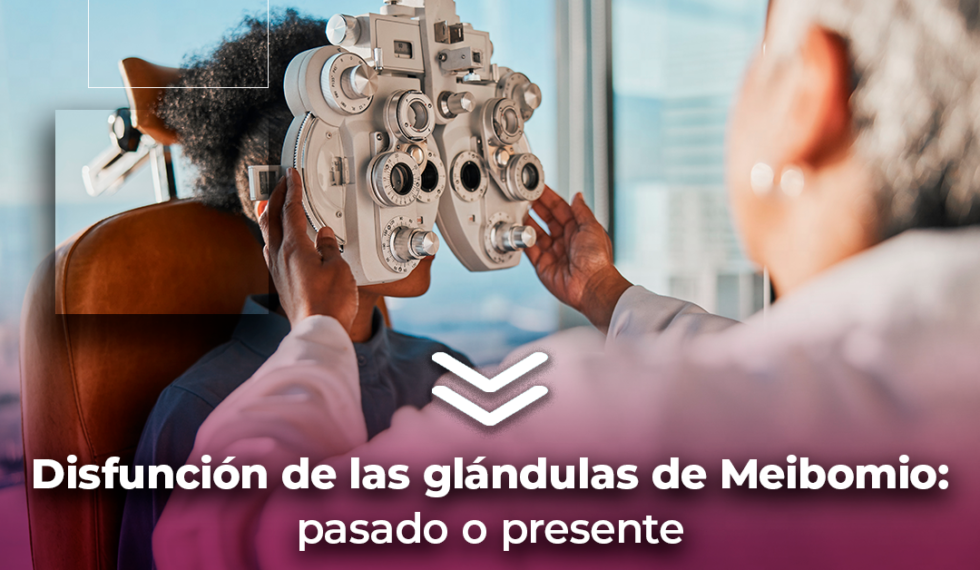 Boletín semanal: Disfunción de las glándulas de Meibomio: pasado o ...